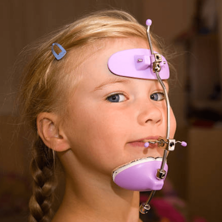 Headgear – Braces Specialists